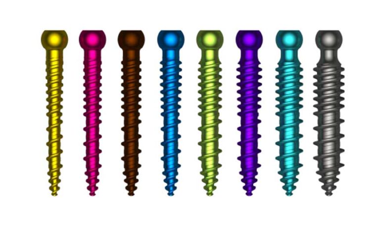 TiLock Modular Spinal System - Genesys Spine